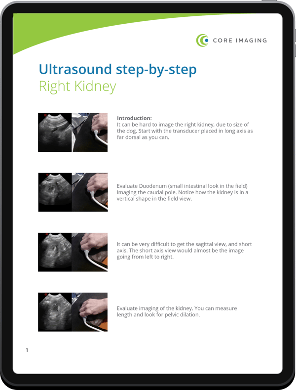 Step-by-Step Guide | Right Kidney
